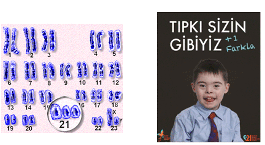Kromozomların ayrılmaması eşey kromozomlarında da görülür.